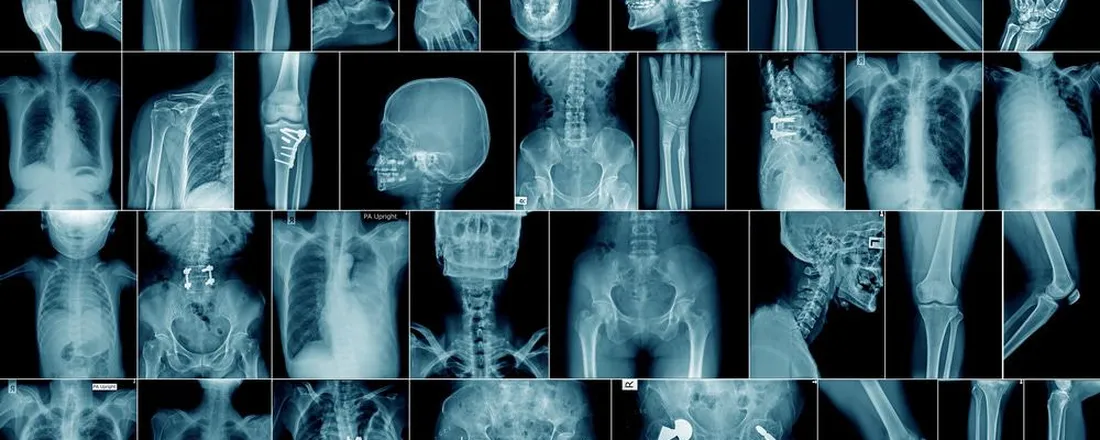 Descomplicando a Interpretação da Radiografia